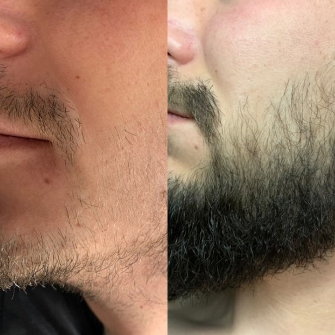 Signs Your Beard is Growing (Even If You Can’t See It Yet)