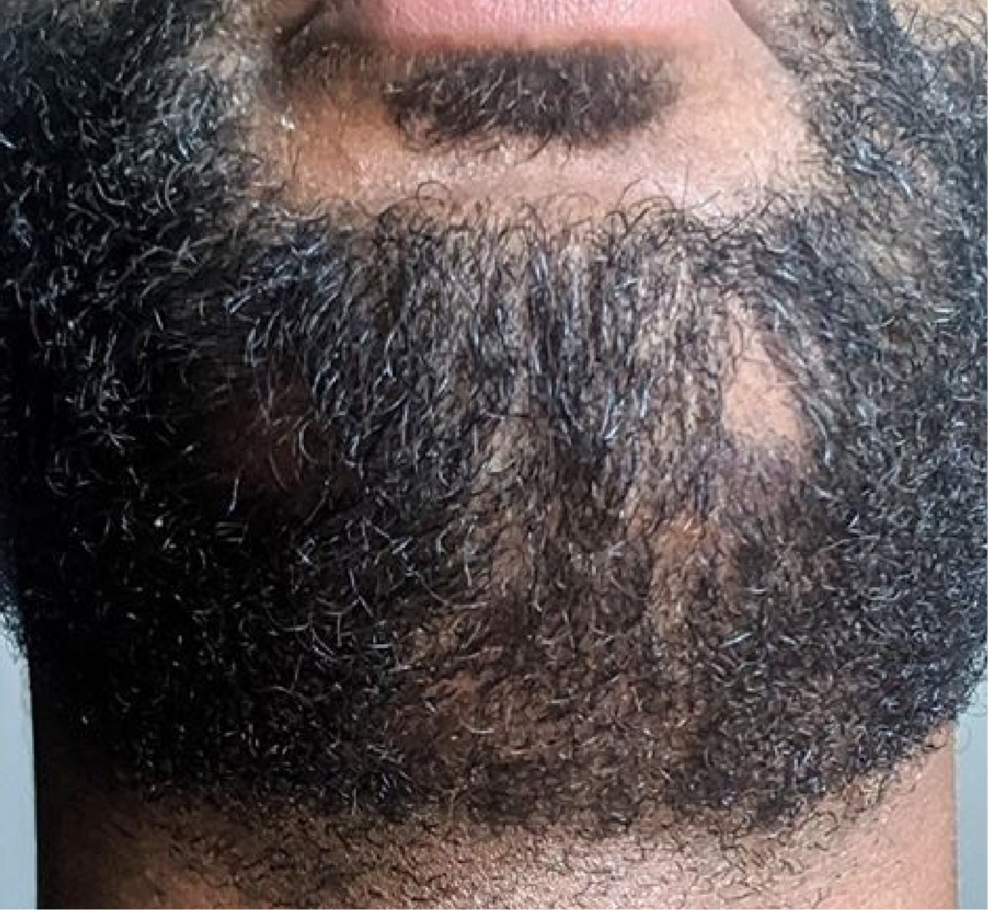 Beard Growth Science