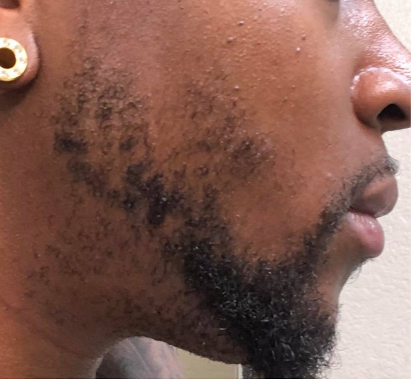 Beard Growth Science